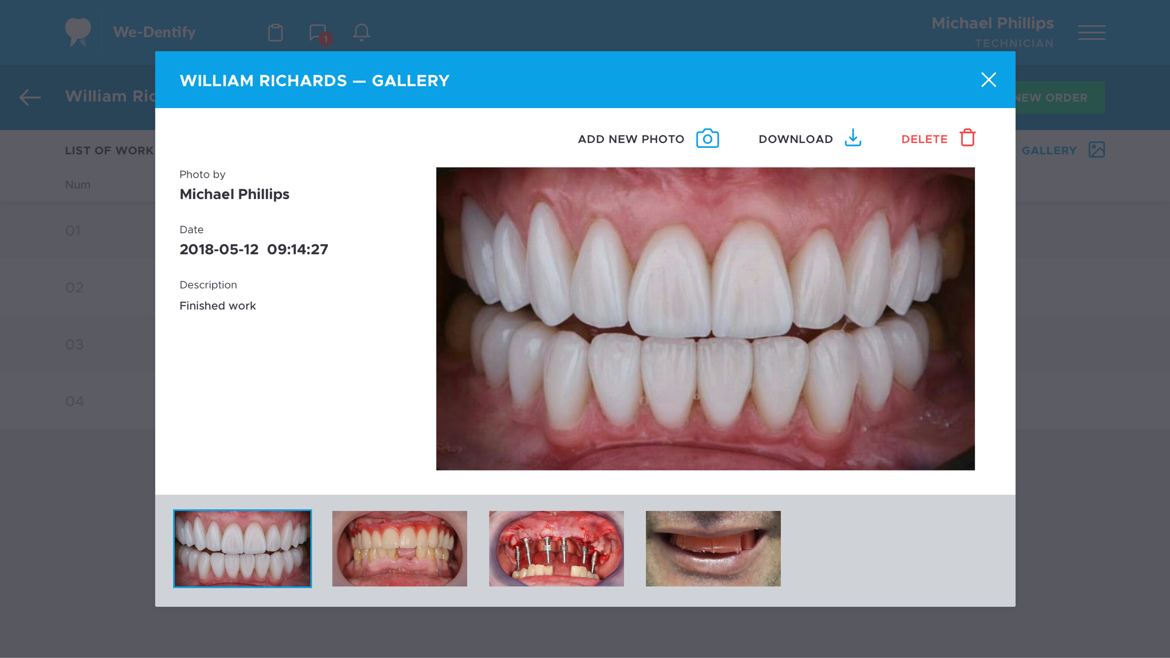 We-Dentify